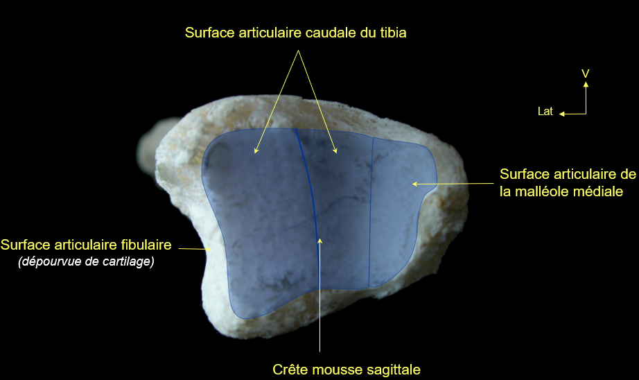 Surface articulaire distale tibia - UE5 Anatomie - Tutorat Associatif ...
